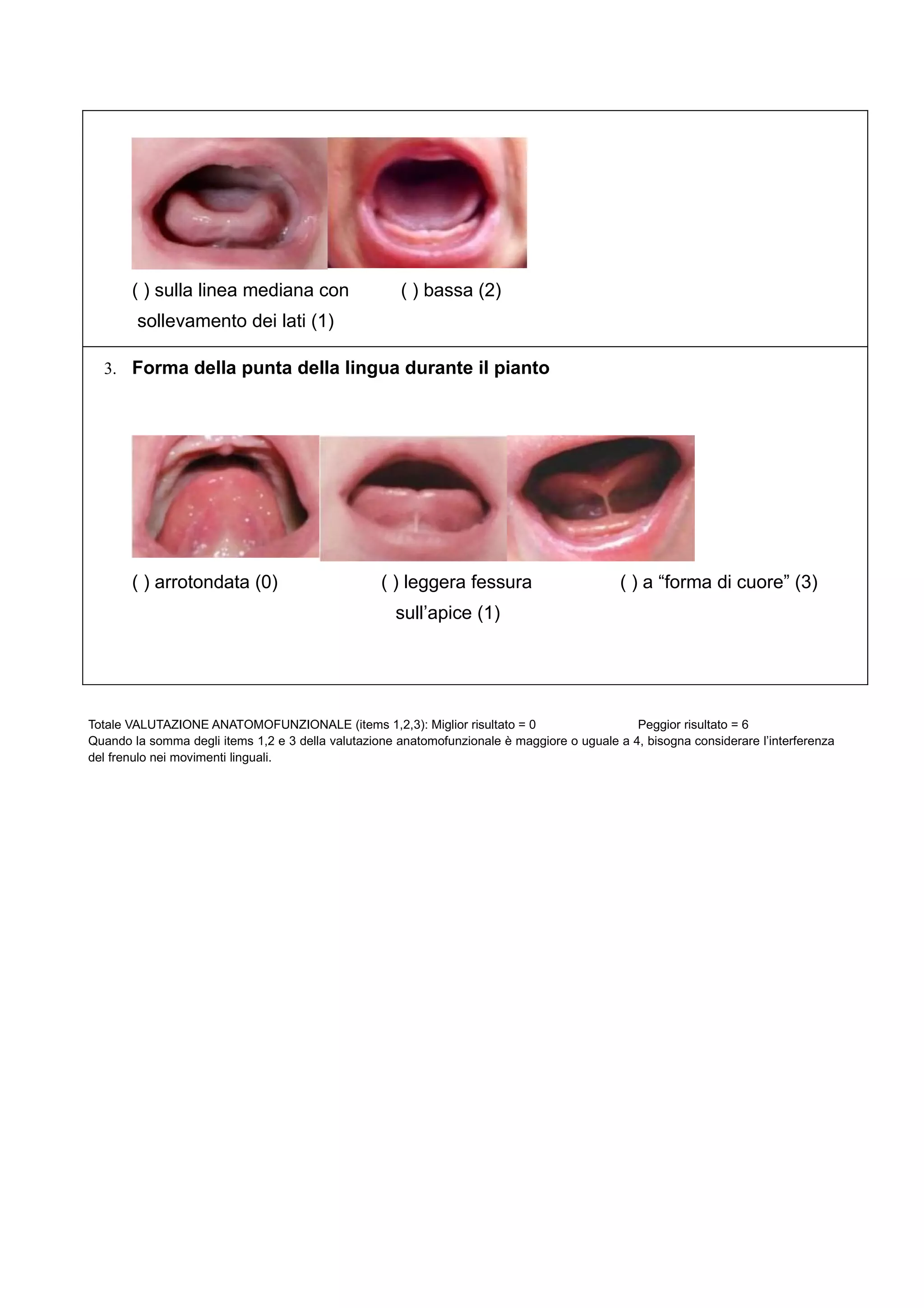 1 protocollo di valutazione del frenulo linguale (neonati) | PDF