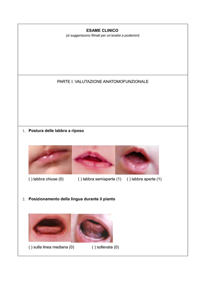 1 protocollo di valutazione del frenulo linguale (neonati) | PDF | Ear ...