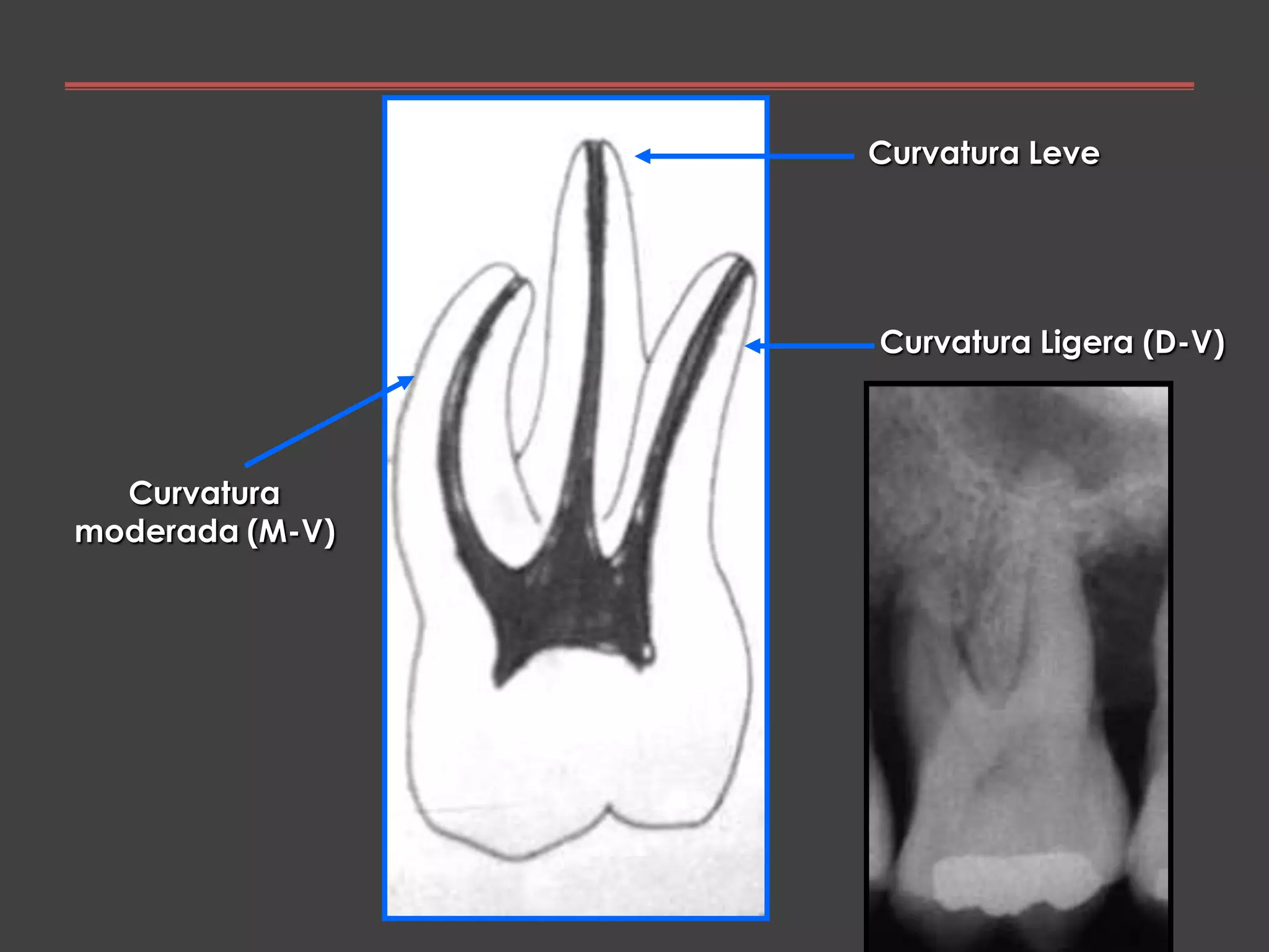 anatomia pulpar | PDF