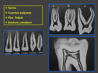 anatomia pulpar | PPT