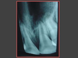 anatomia pulpar | PDF