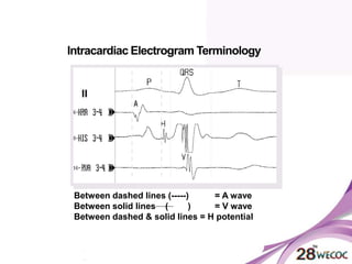 1Raharjo SB - Studi Elektrofisiologi.pptx