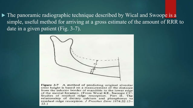 Residual ridge reduction in removable prosthodontics | PPTX