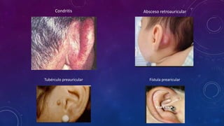 1 Semiología Oído externo y patologías mas frecuentes.pptx
