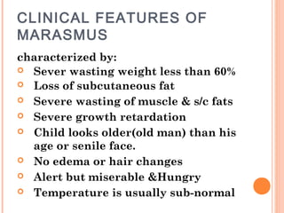 1slide share malnutrition modify | PPT