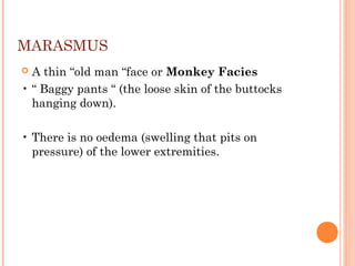 1slide share malnutrition modify | PPT