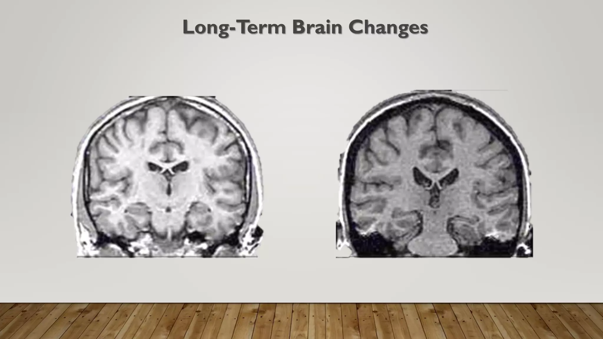 Trauma Informed Game Based Learning for Kids | PDF