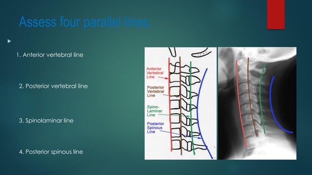 1) Spinal Cord radiology gross anatomy central nervous system | PDF