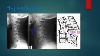 1) Spinal Cord radiology gross anatomy central nervous system | PDF ...