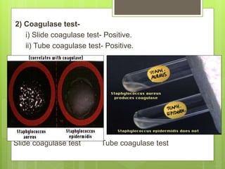 1 STAPHYLOCOCCUS.ppt