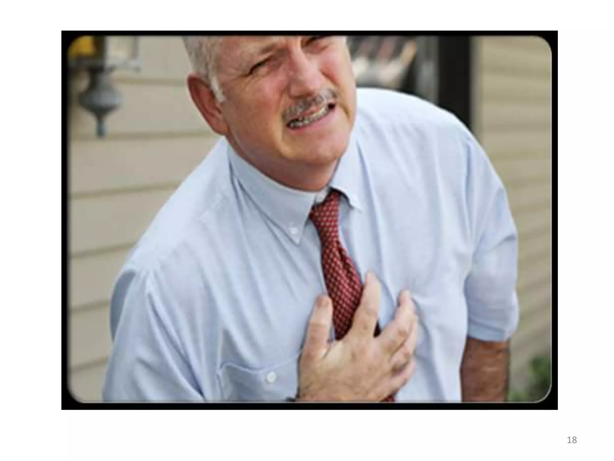 Chest Pain- Differential Diagnosis | PPTX