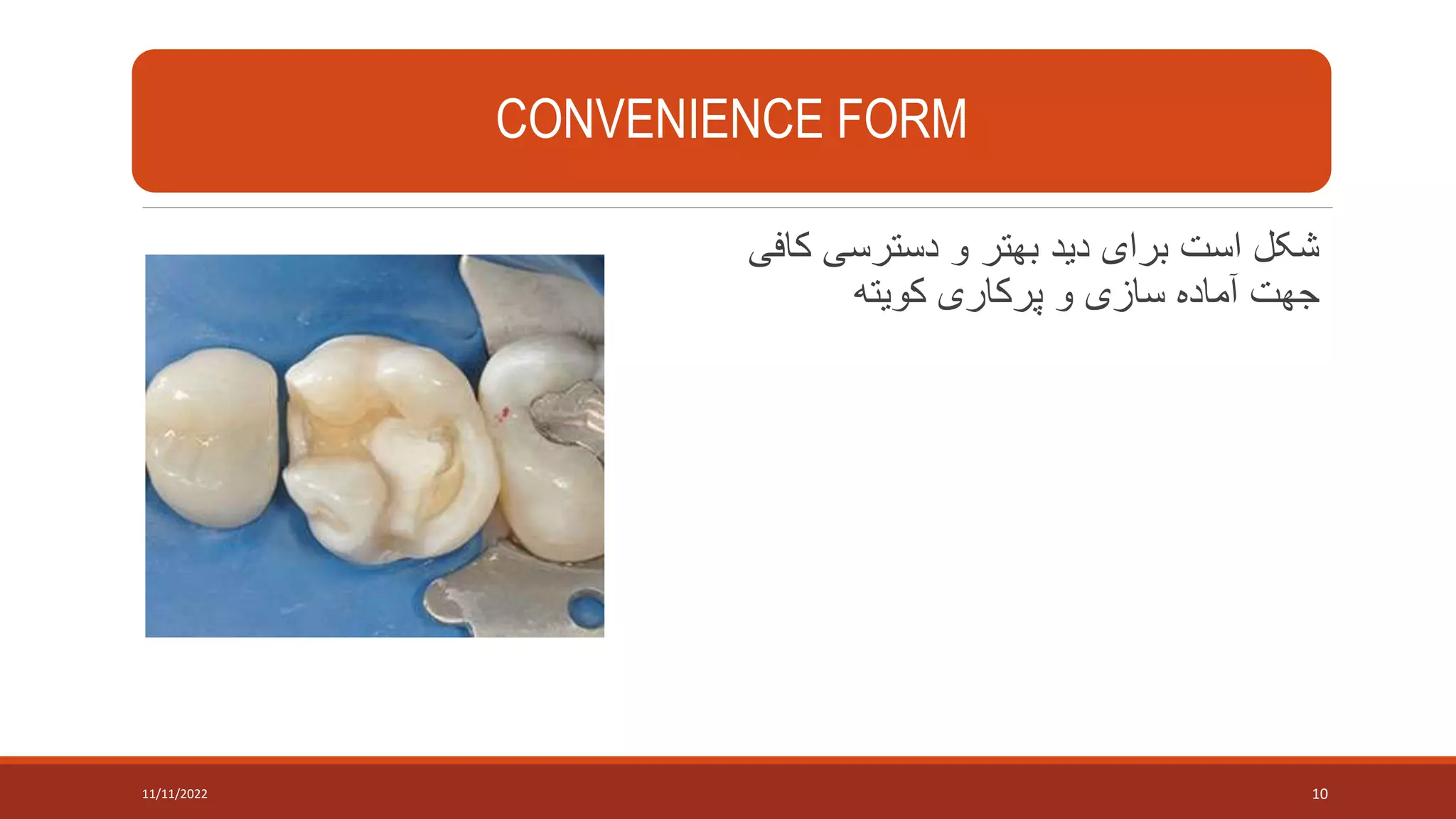 اصول اماده سازی کلاس دوم ، class 2 cavity preparation.pptx
