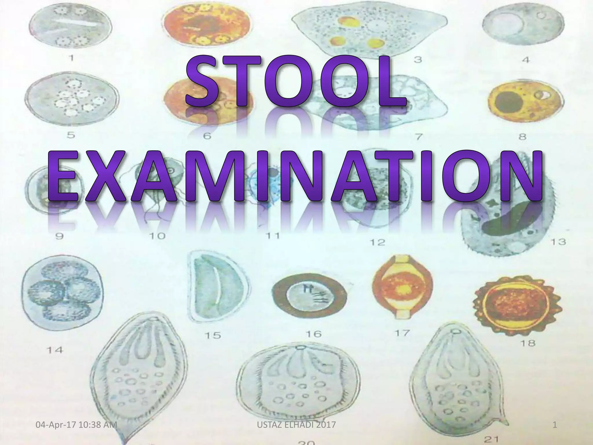 1 stool general 19 | PPTX