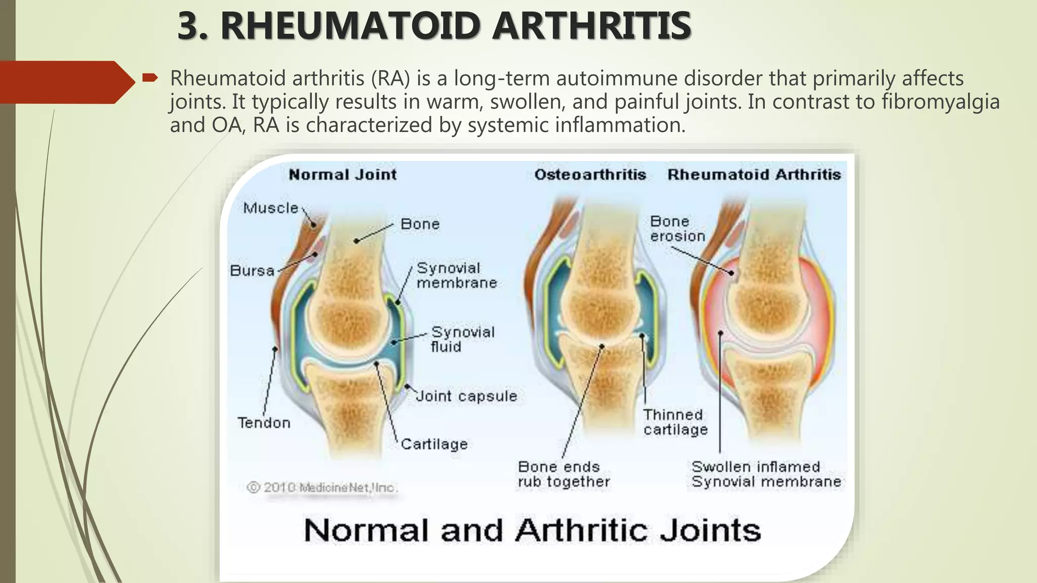 The role of the central nervous system in the generation and ...