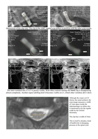 1st presentation with selected scanimages | PDF