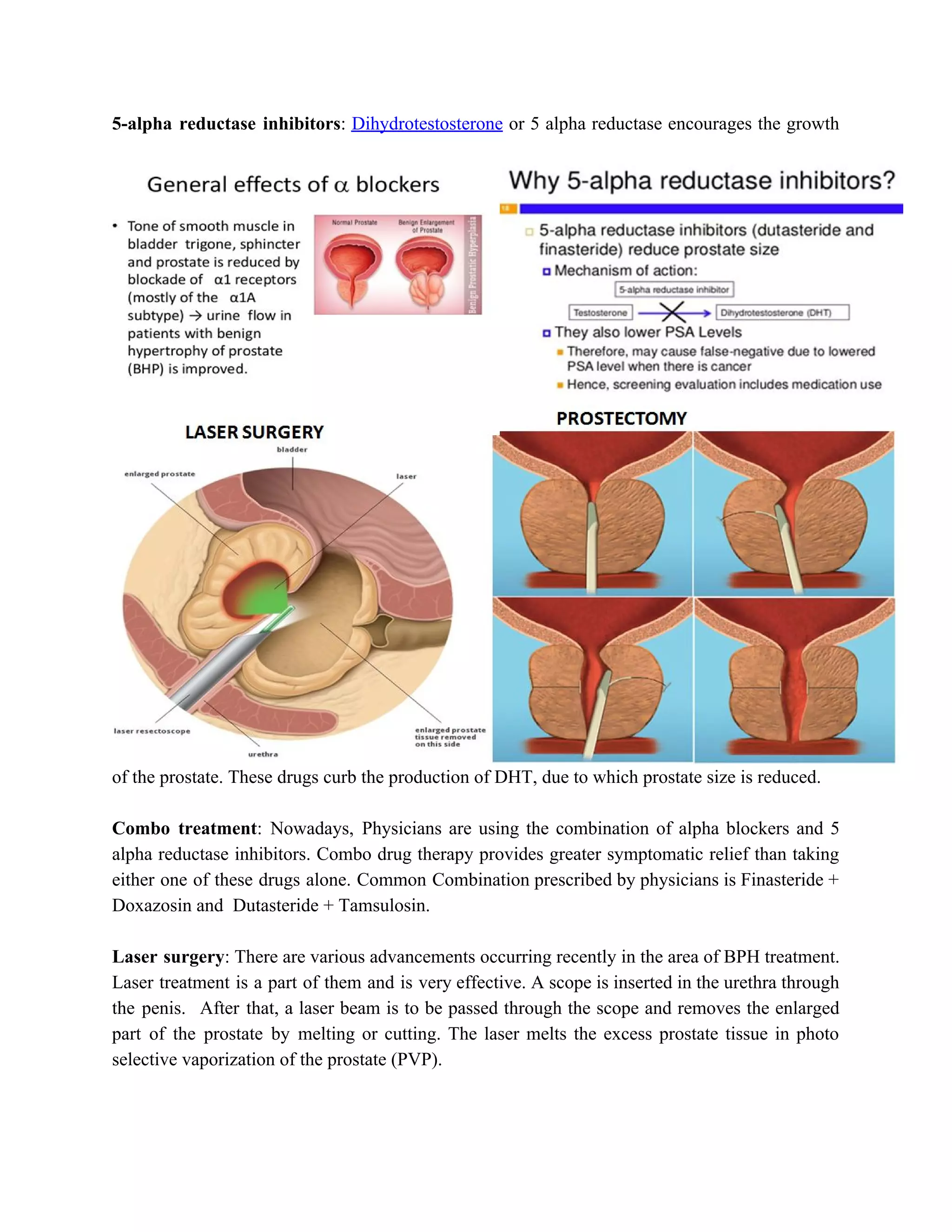 STRATEGIES FOR MANAGING BPH | PDF