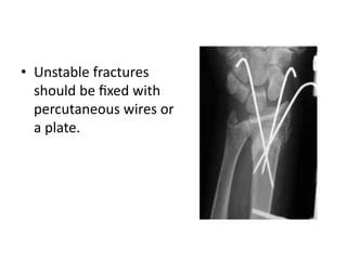 Smith Fracture Garden Spade