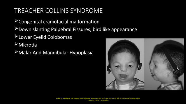 Development, anatomy and growth of mandible | PPT