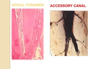 Apical Foramen Histology