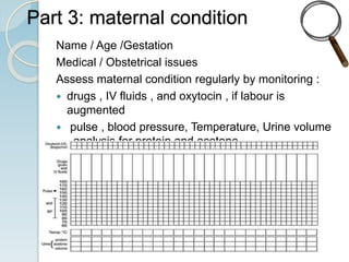 1st stage managment | PPT