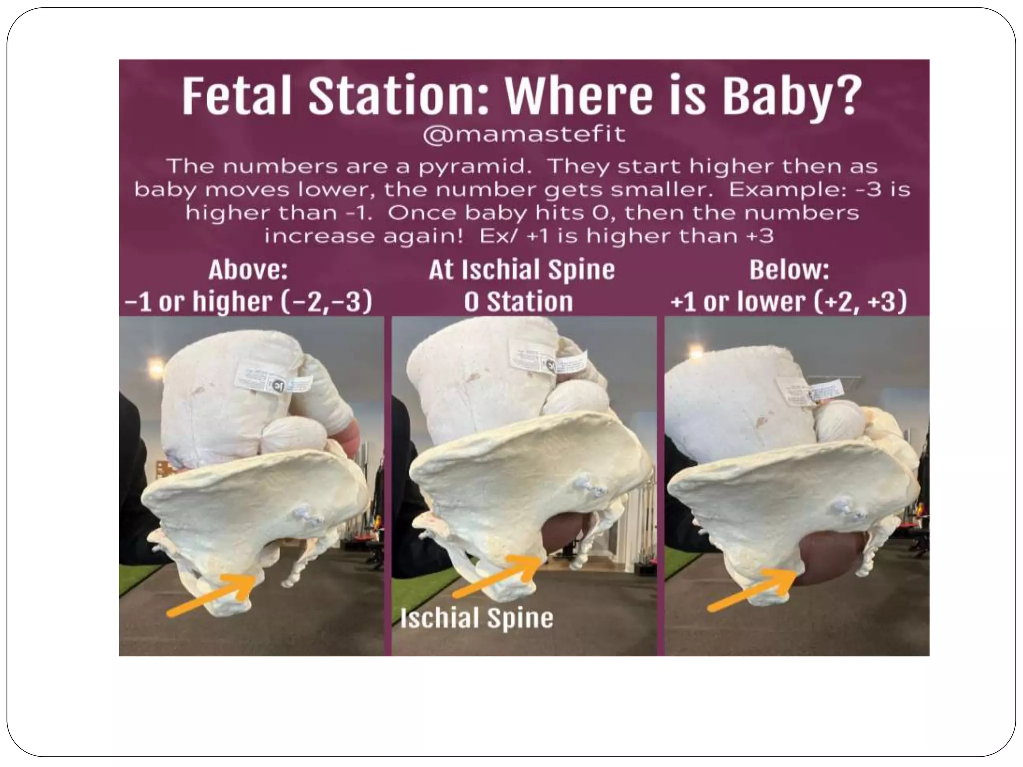 1st stage of labor.pptx