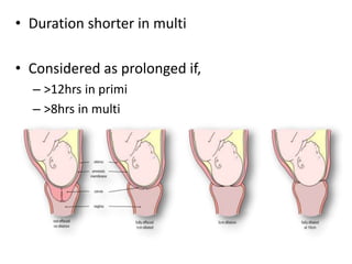 1st stage of labour | PPTX