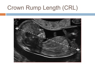 First timester ultrasound. | PPTX