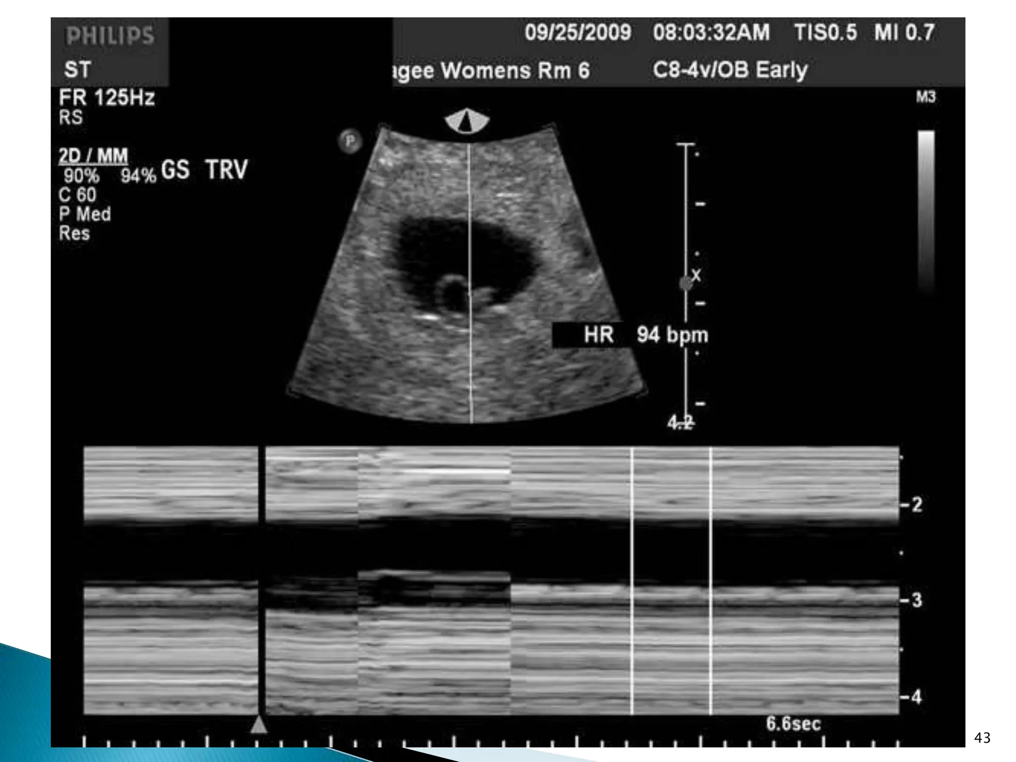 1st TRIM METHODOLOGIC OBST SCANNING TECHNIQUES GROUP 12 FINAL.pptx