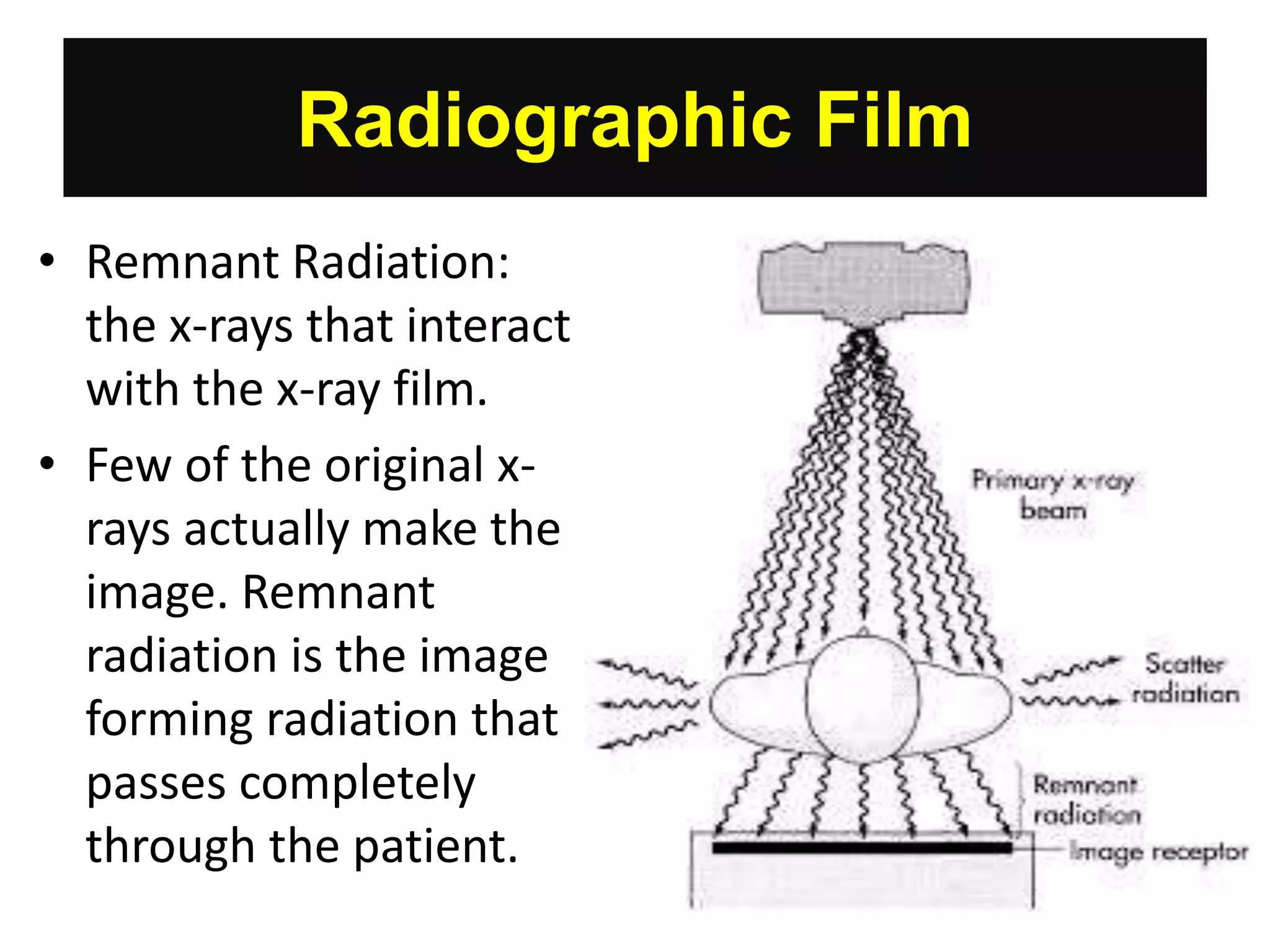radiographic film | PPTX
