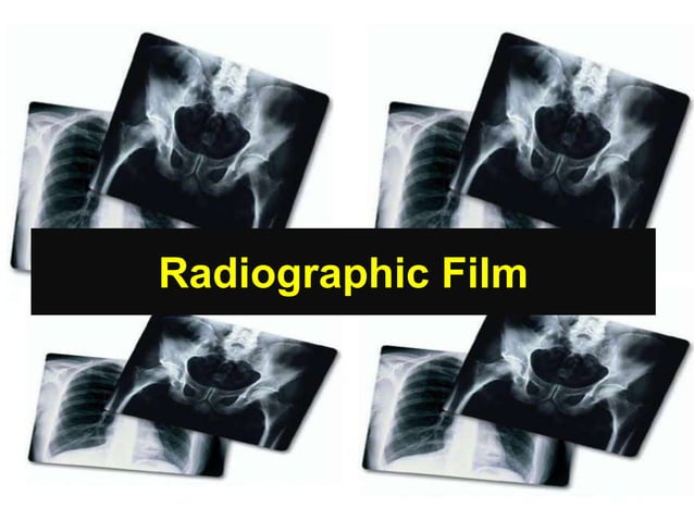 radiographic film | PPTX