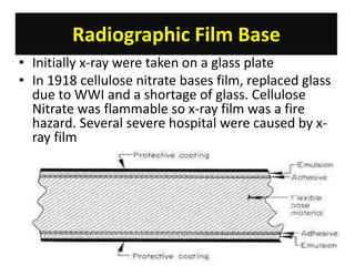 radiographic film | PPTX