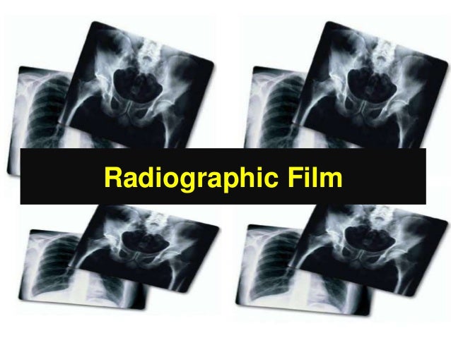 radiographic film