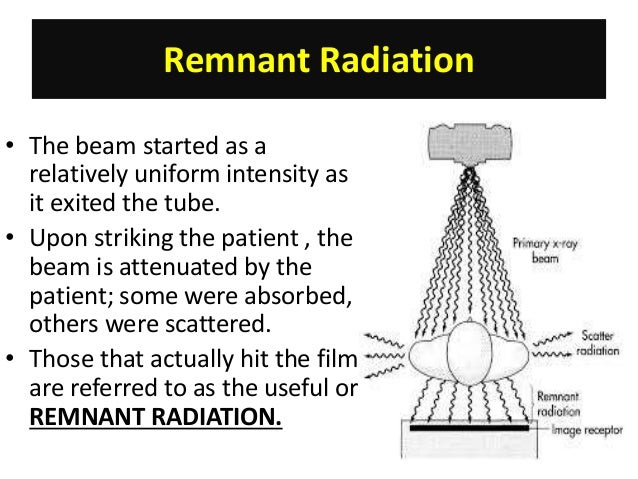 radiographic film