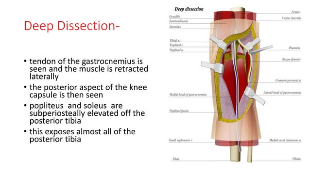 surgerical approach knee | PPT