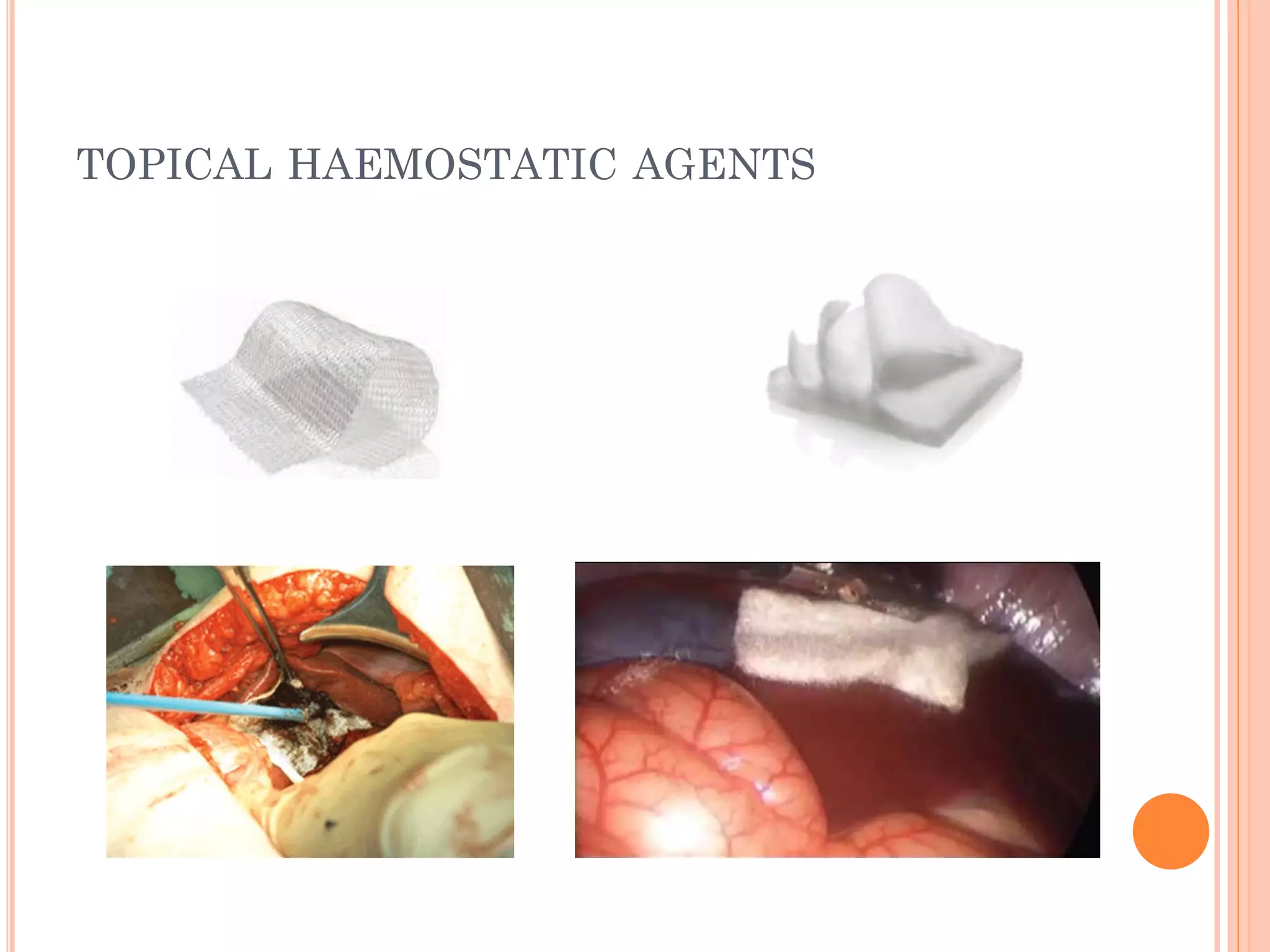 1 surgical techniques and topical haemostatic agents in patient | PPT