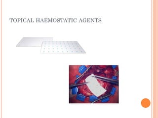 1 surgical techniques and topical haemostatic agents in patient | PPT