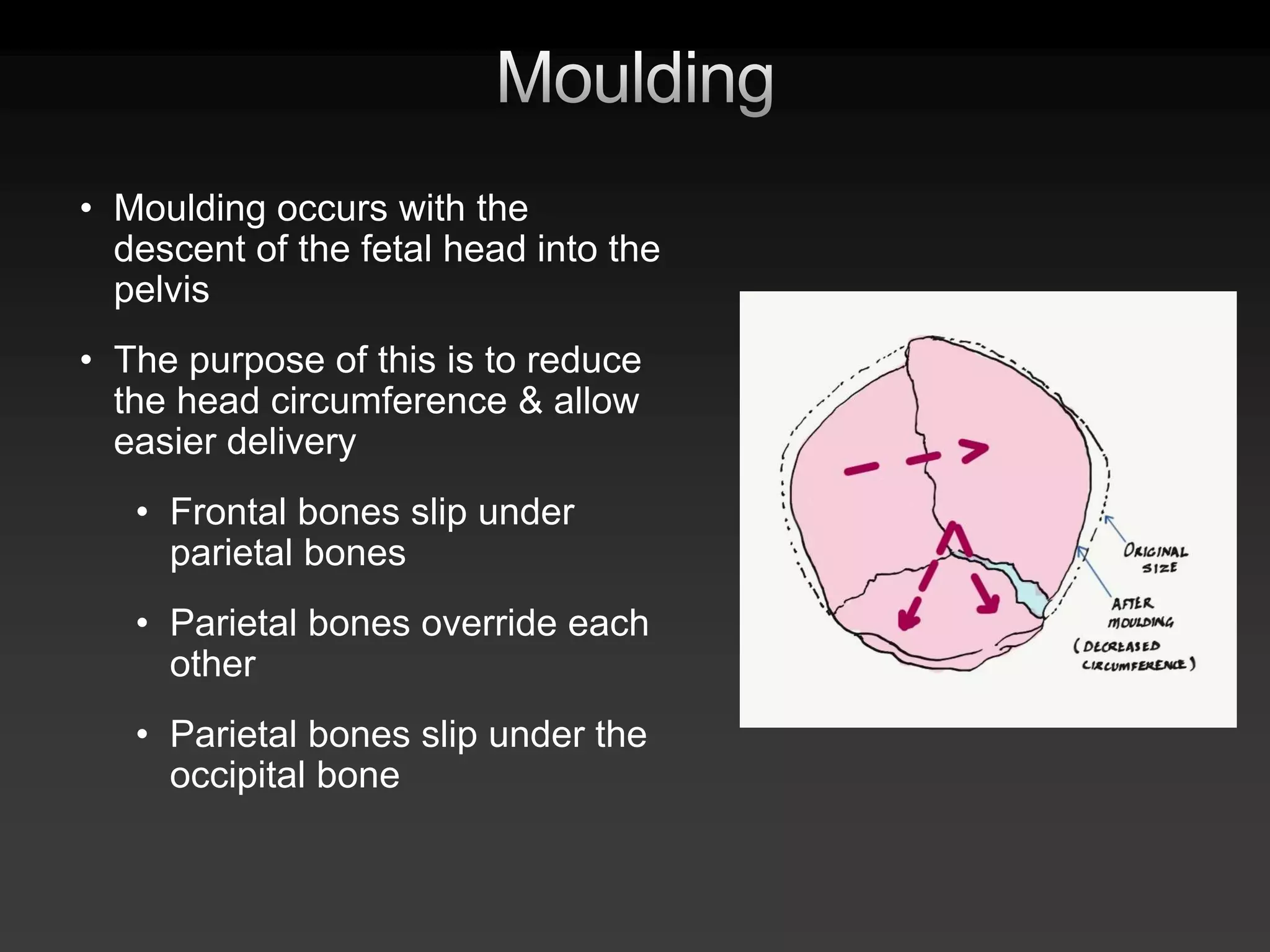 Obstetric Terminology | PPTX