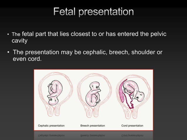 Obstetric Terminology | PPTX | Infertility | Reproductive Health