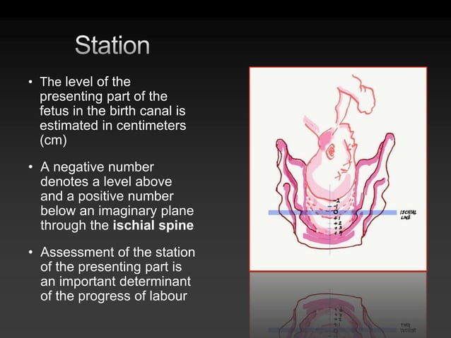 Obstetric Terminology | PPTX | Infertility | Reproductive Health