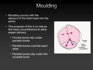 Obstetric Terminology | PPTX