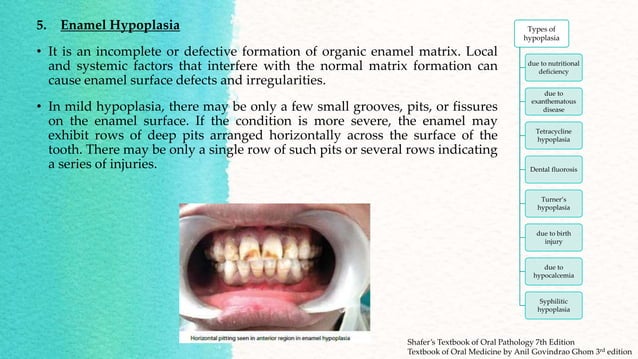 Tooth anatomy and its enigma.pptx