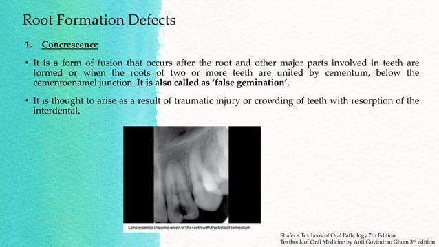 Tooth anatomy and its enigma.pptx