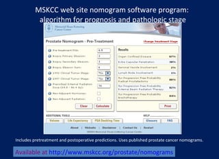NY Prostate Cancer Conference - K. Touijer - Session 4: Predicting ...