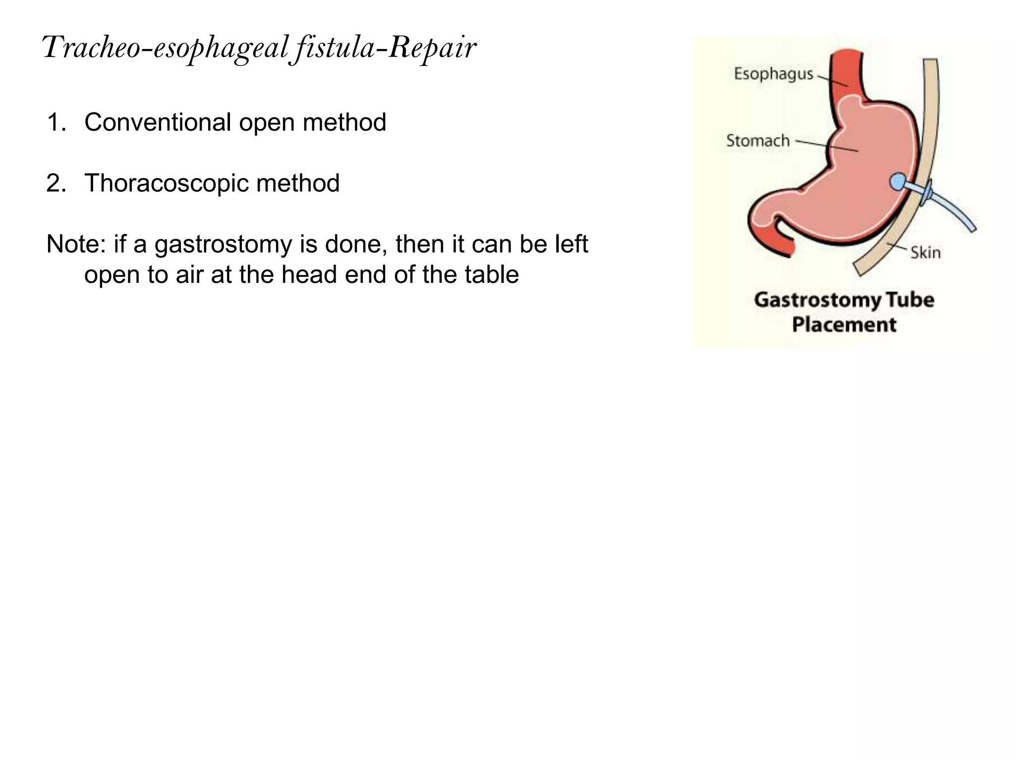 Tracheo Esophageal Fistula and Anesthesia | PPTX