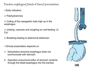 Tracheo Esophageal Fistula and Anesthesia | PPTX