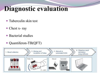 1 tuberculosis | PPT