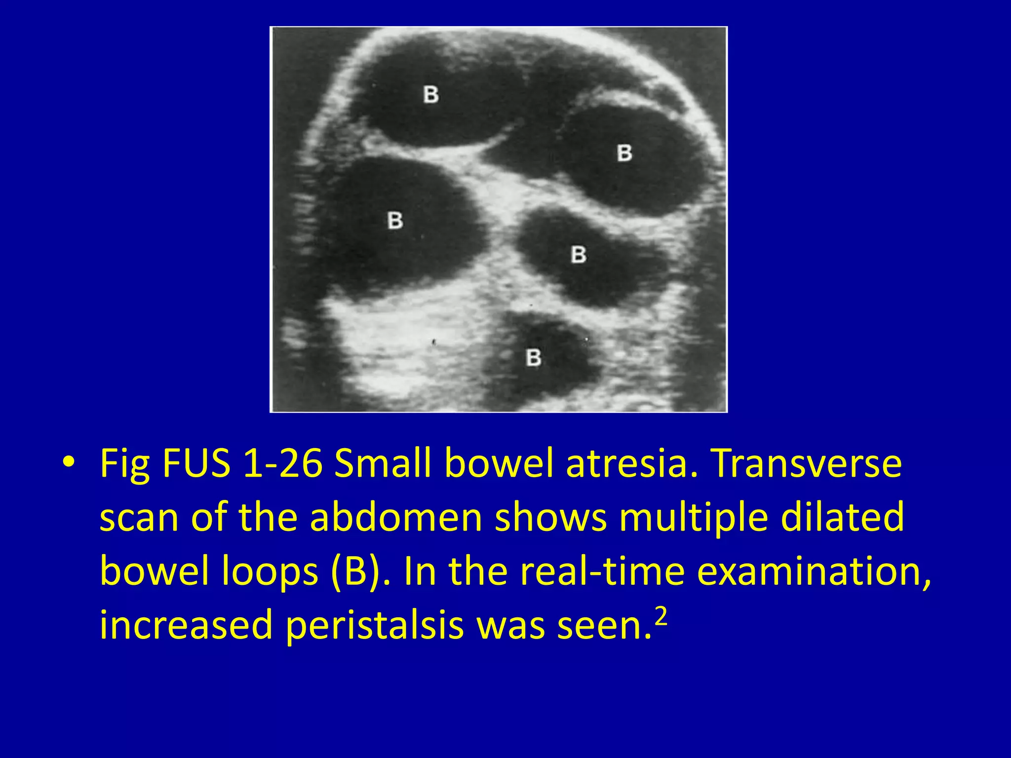 1 ultrasound diagnosis of fetal anomalies | PPTX