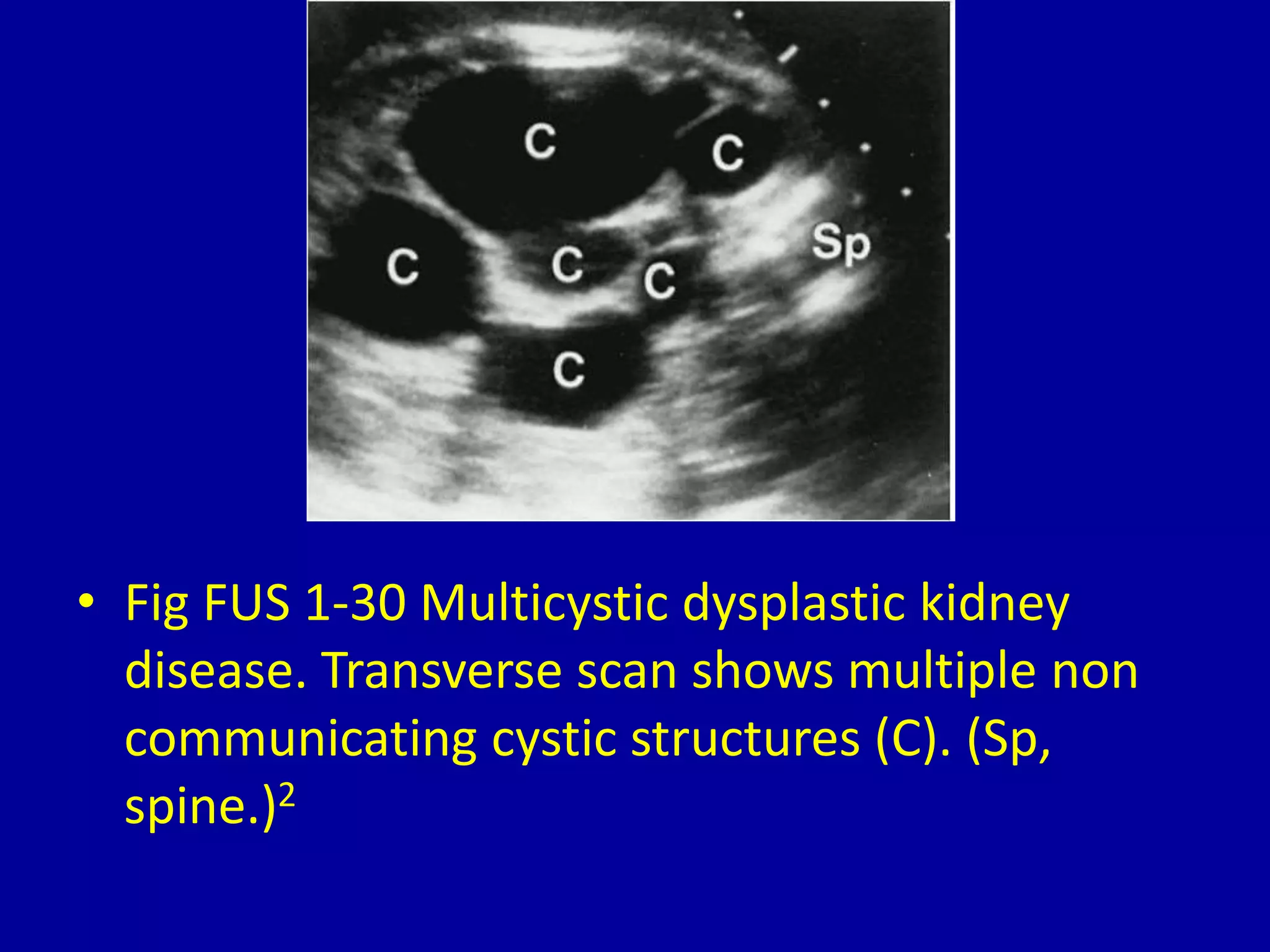 1 ultrasound diagnosis of fetal anomalies | PPTX