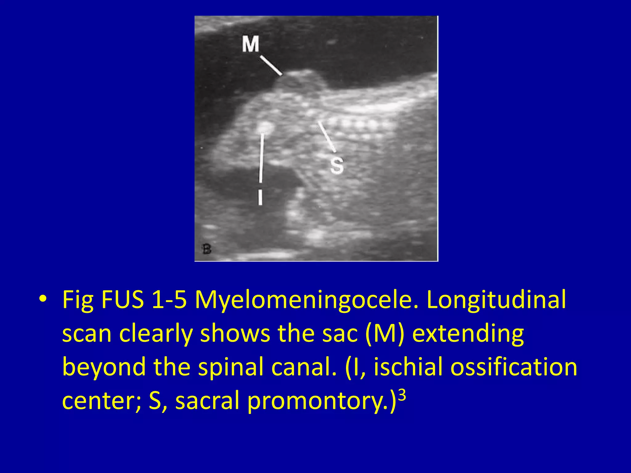 1 ultrasound diagnosis of fetal anomalies | PPTX
