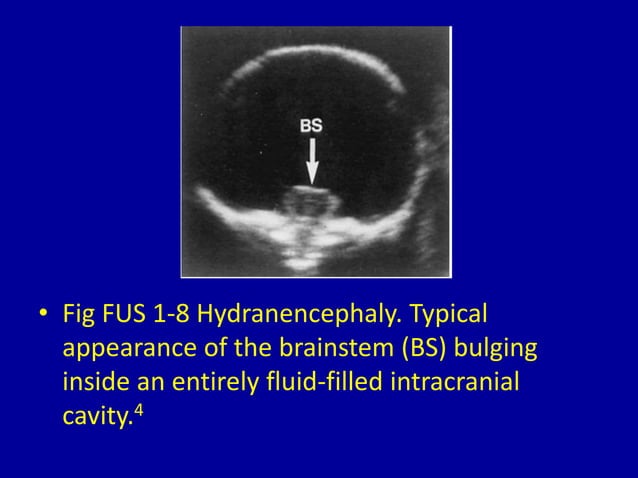 1 ultrasound diagnosis of fetal anomalies | PPTX